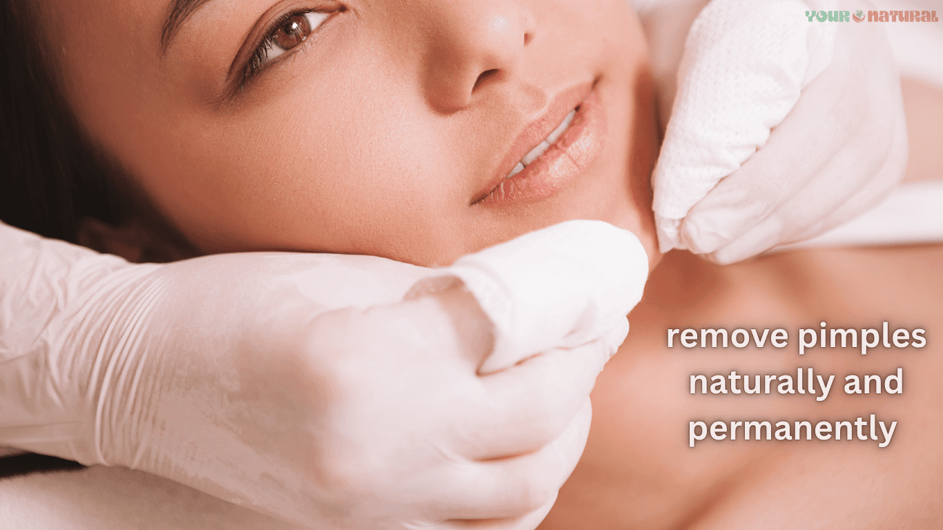10 Effective Ways to How to Remove Pimples Naturally and Permanently